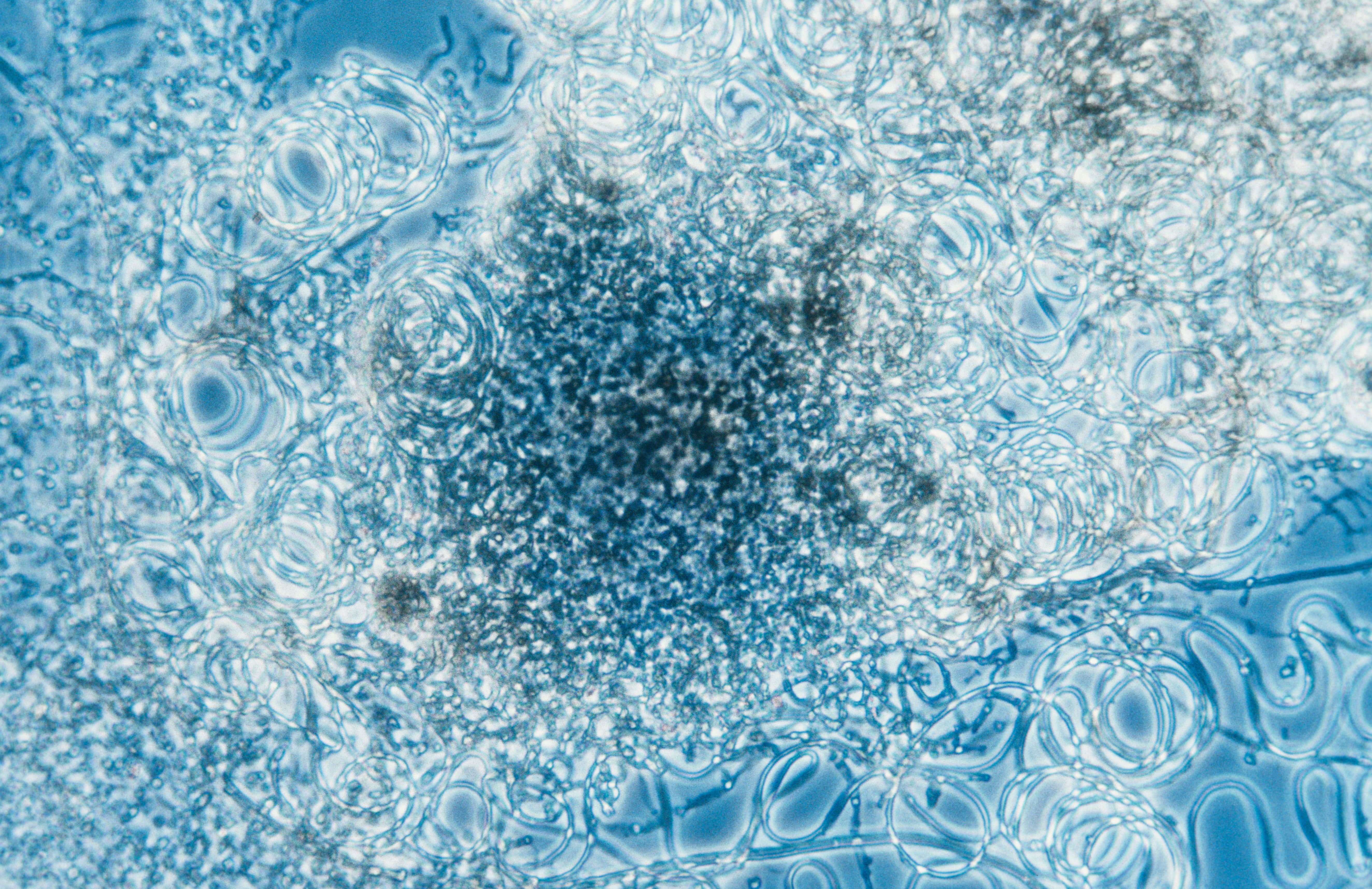 UAMH Centre for Global Microfungal Biodiversity