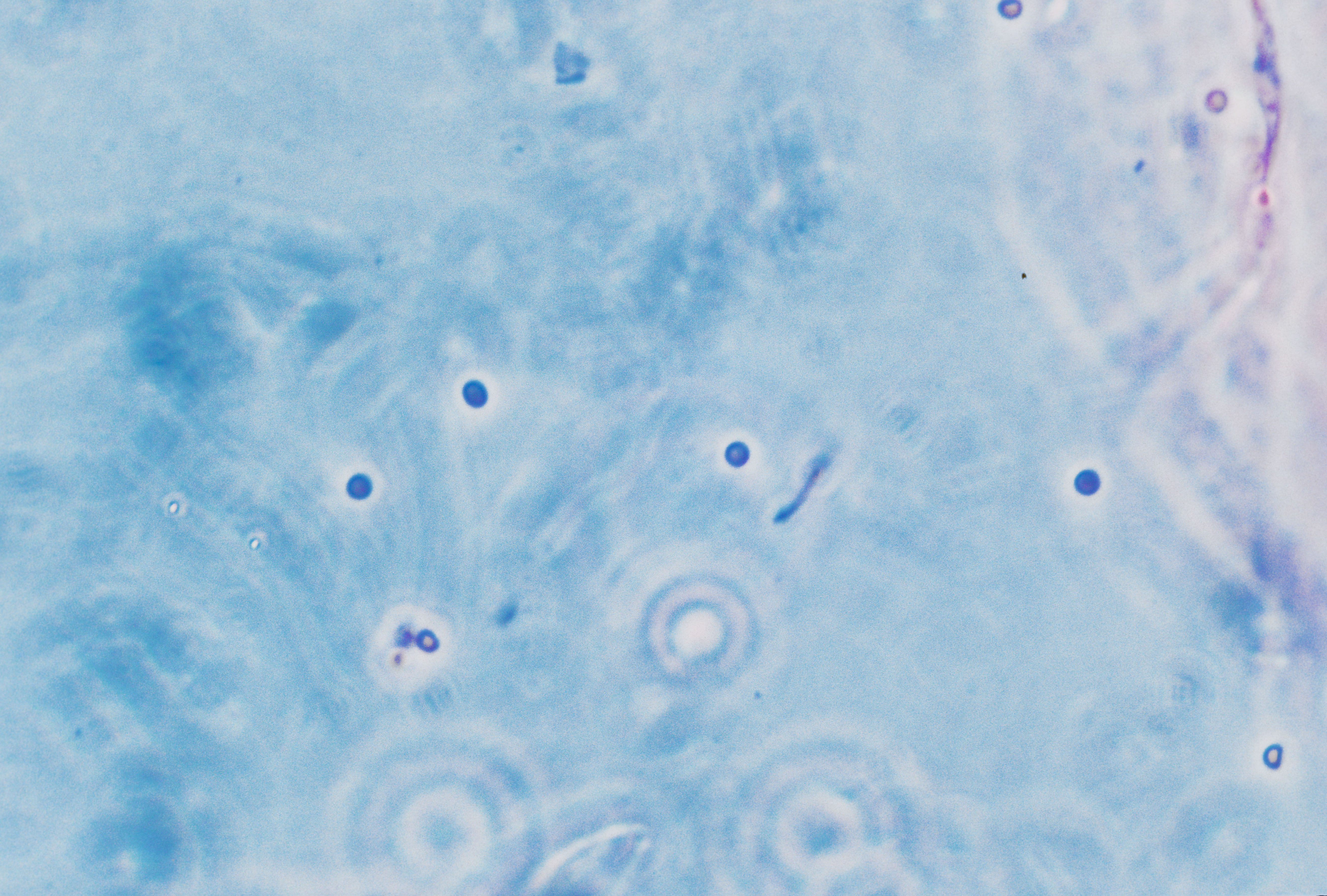 UAMH Centre for Global Microfungal Biodiversity