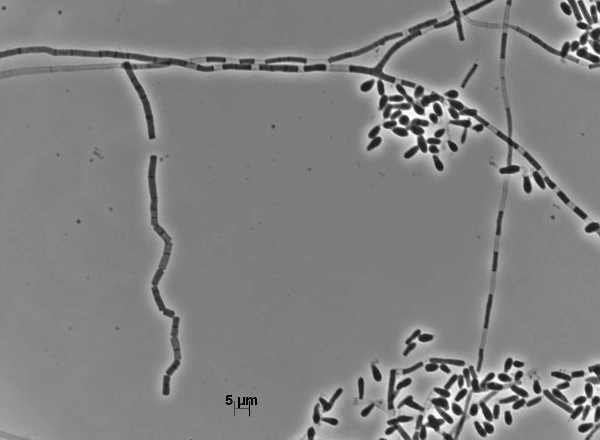 UAMH Centre for Global Microfungal Biodiversity