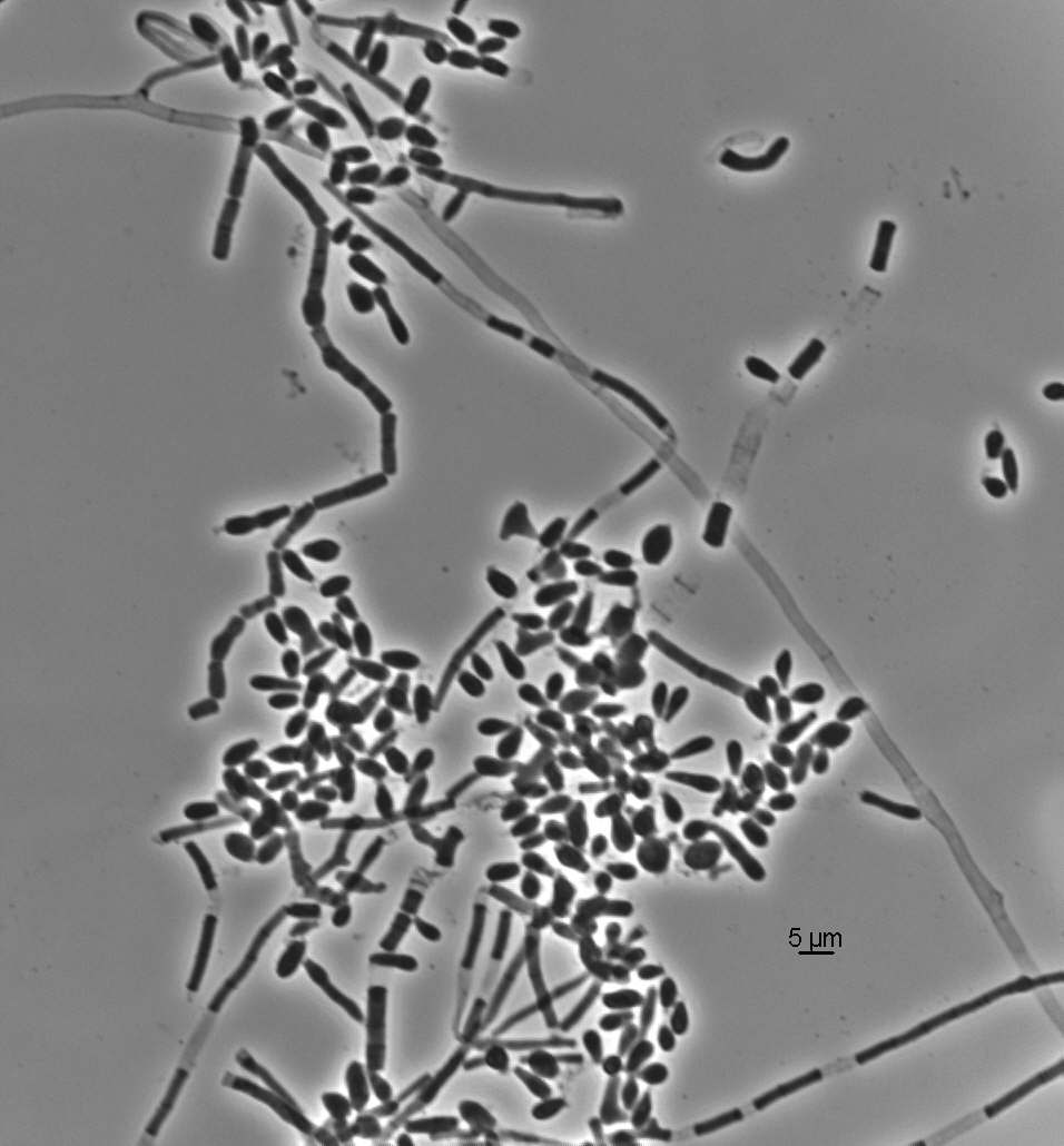 UAMH Centre for Global Microfungal Biodiversity