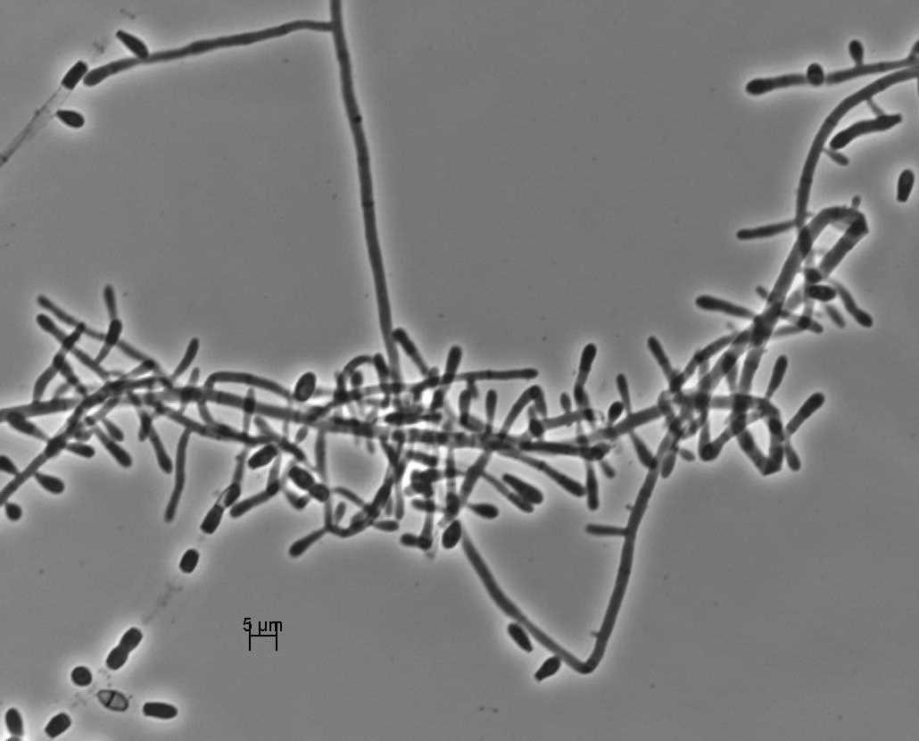 UAMH Centre for Global Microfungal Biodiversity