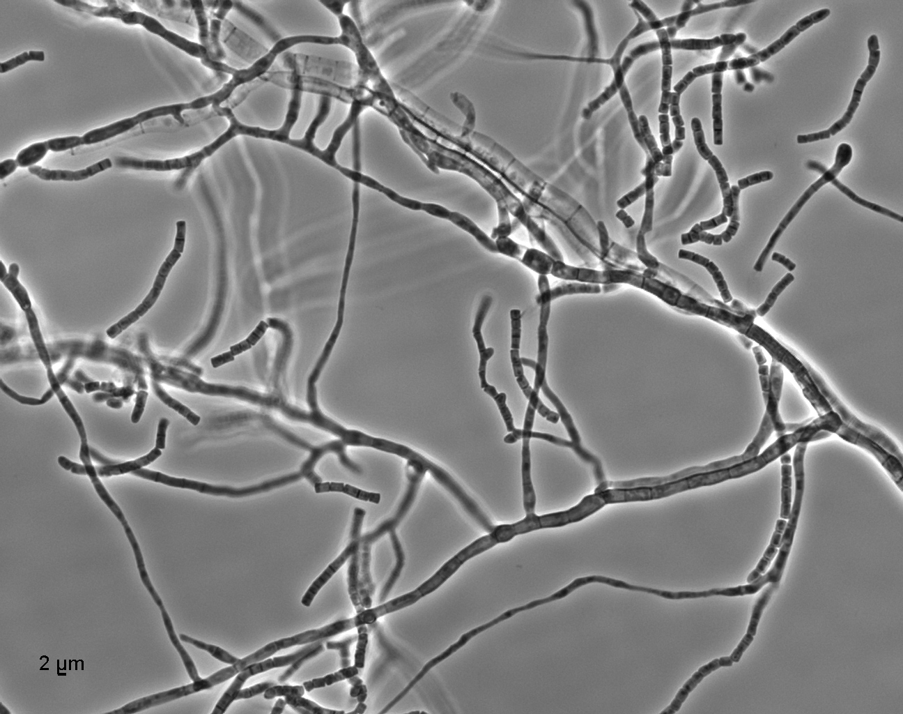 UAMH Centre for Global Microfungal Biodiversity