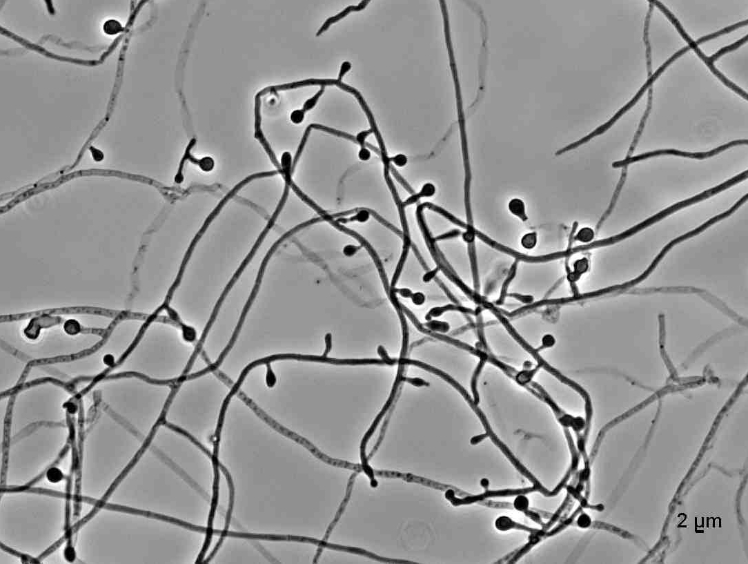 UAMH Centre for Global Microfungal Biodiversity