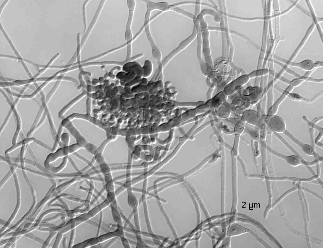 UAMH Centre for Global Microfungal Biodiversity