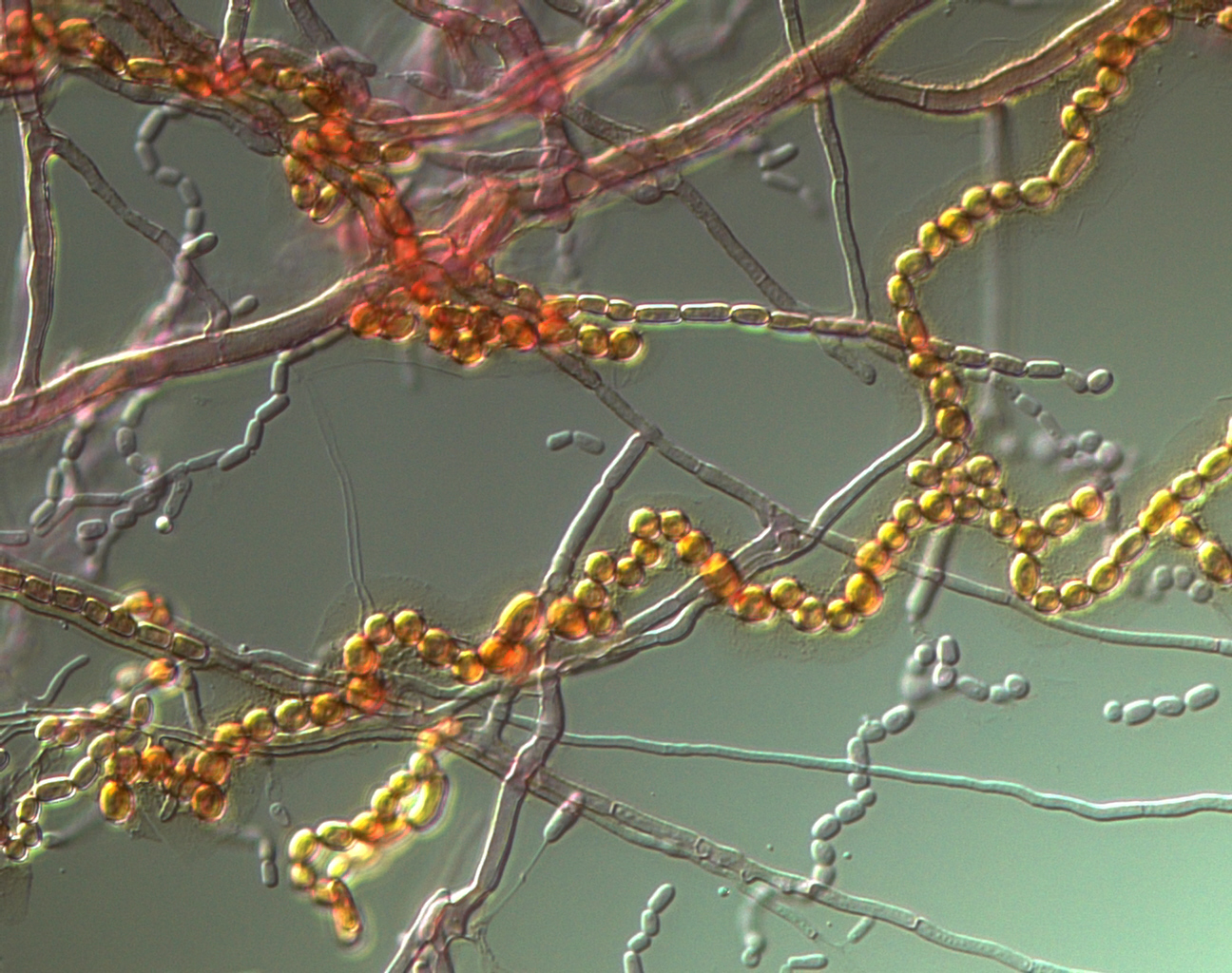 UAMH Centre for Global Microfungal Biodiversity