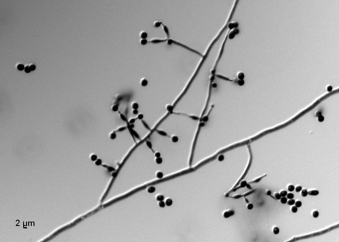 UAMH Centre for Global Microfungal Biodiversity