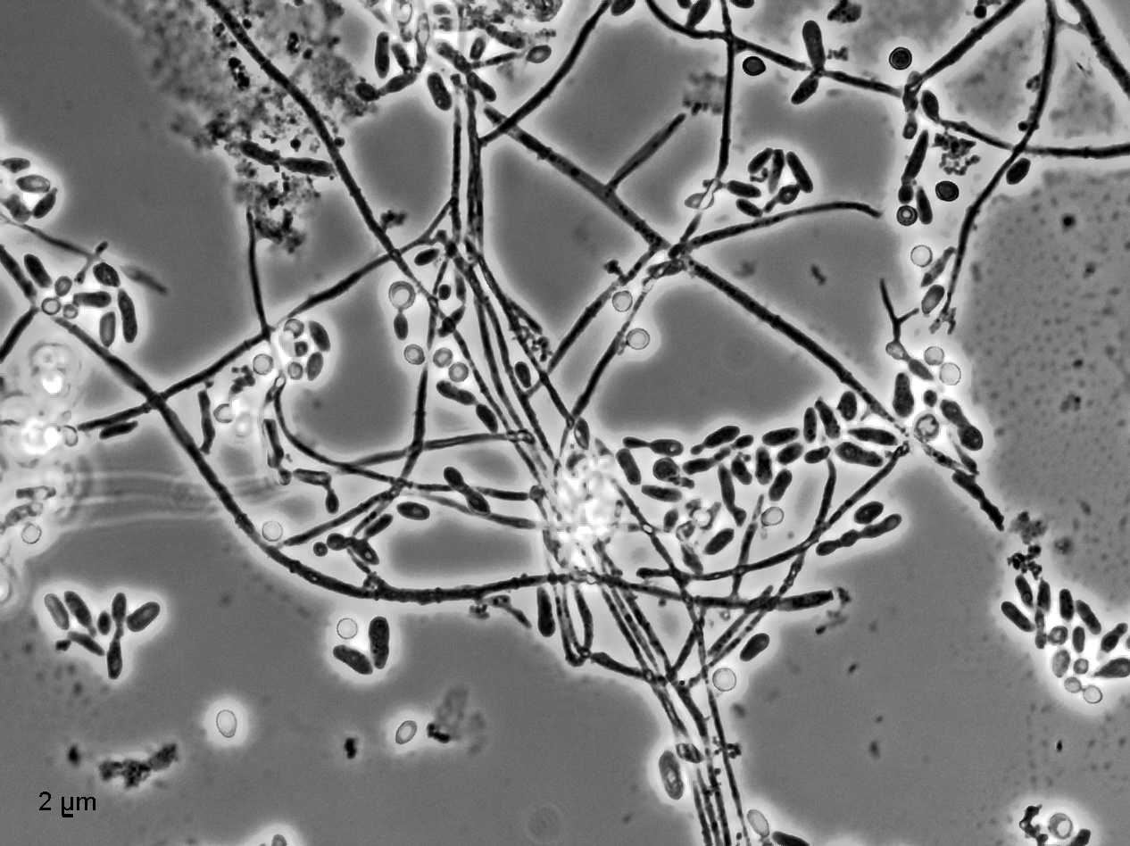UAMH Centre for Global Microfungal Biodiversity