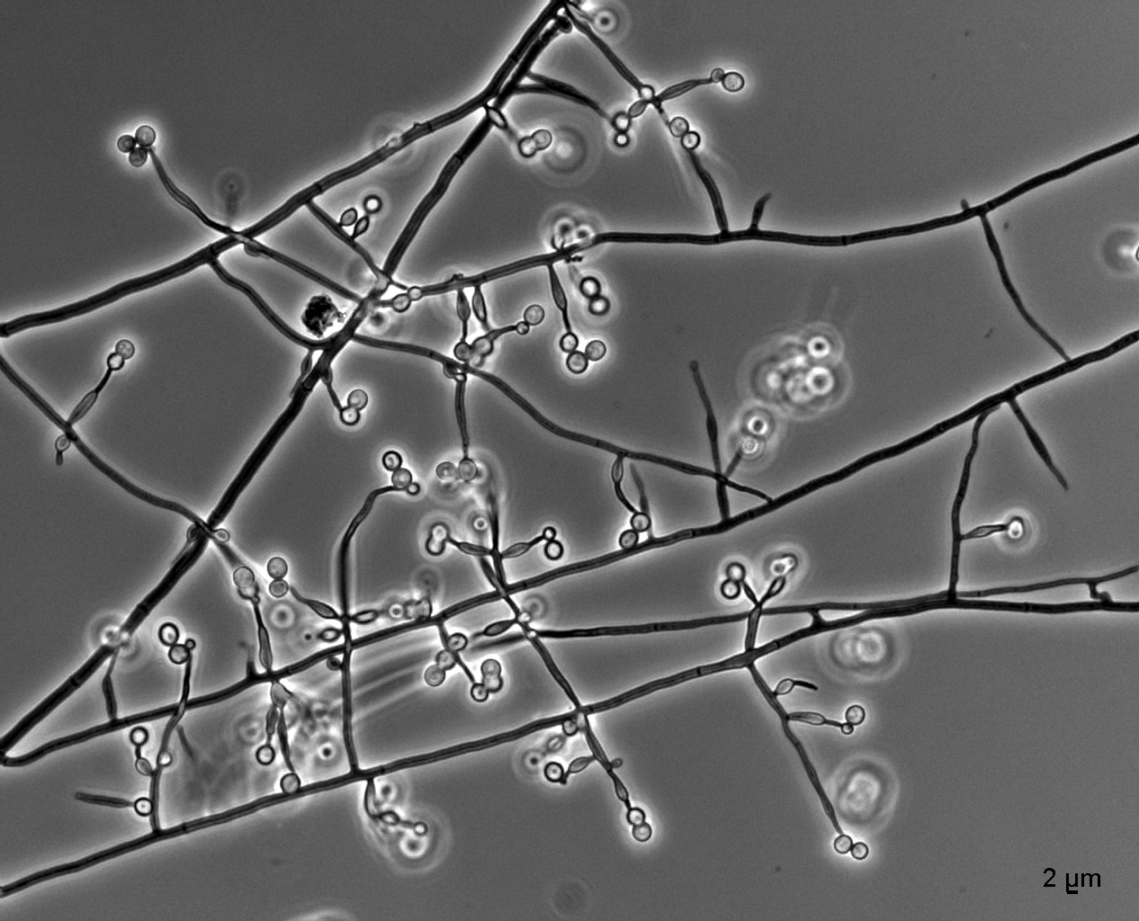 UAMH Centre for Global Microfungal Biodiversity