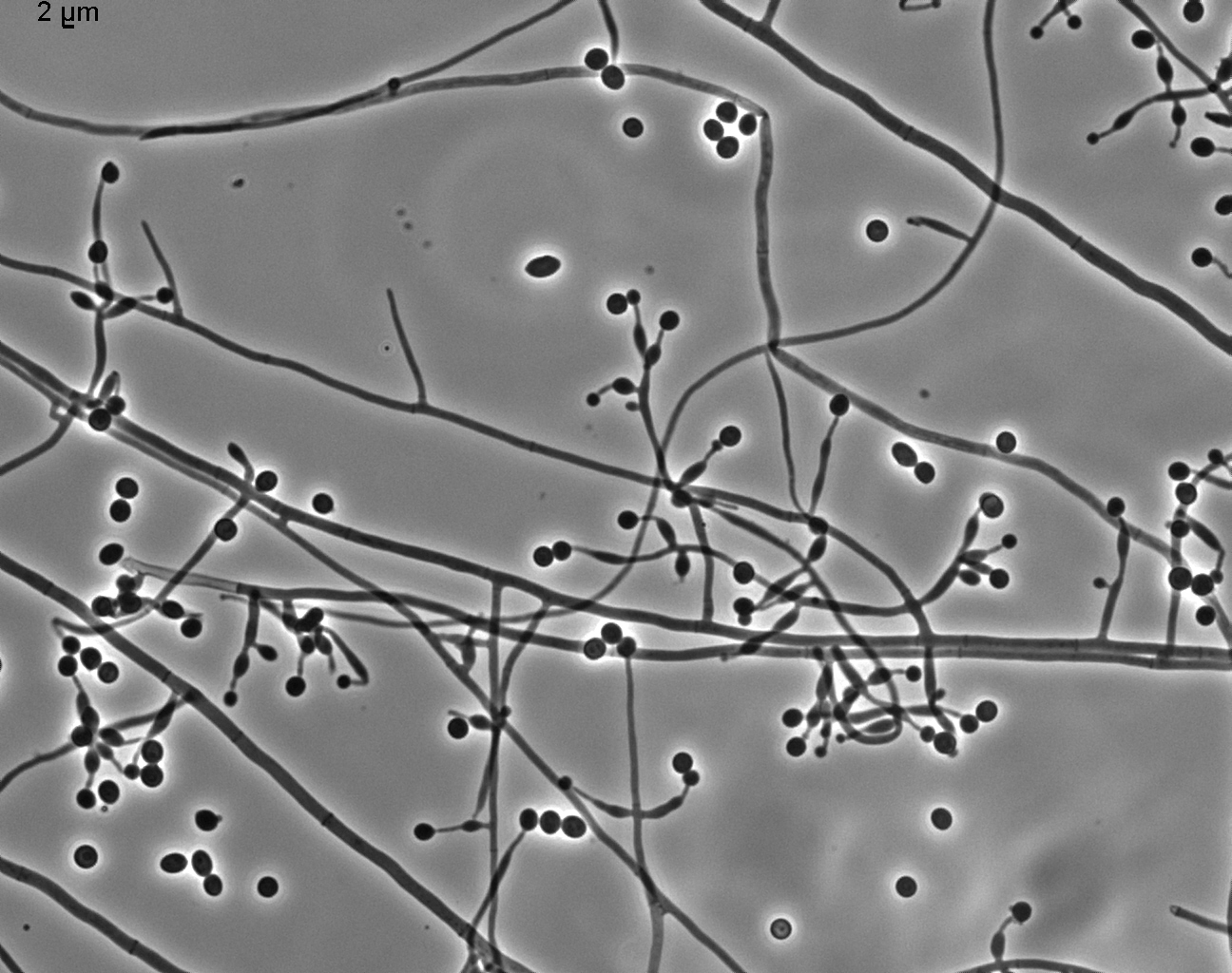 UAMH Centre for Global Microfungal Biodiversity