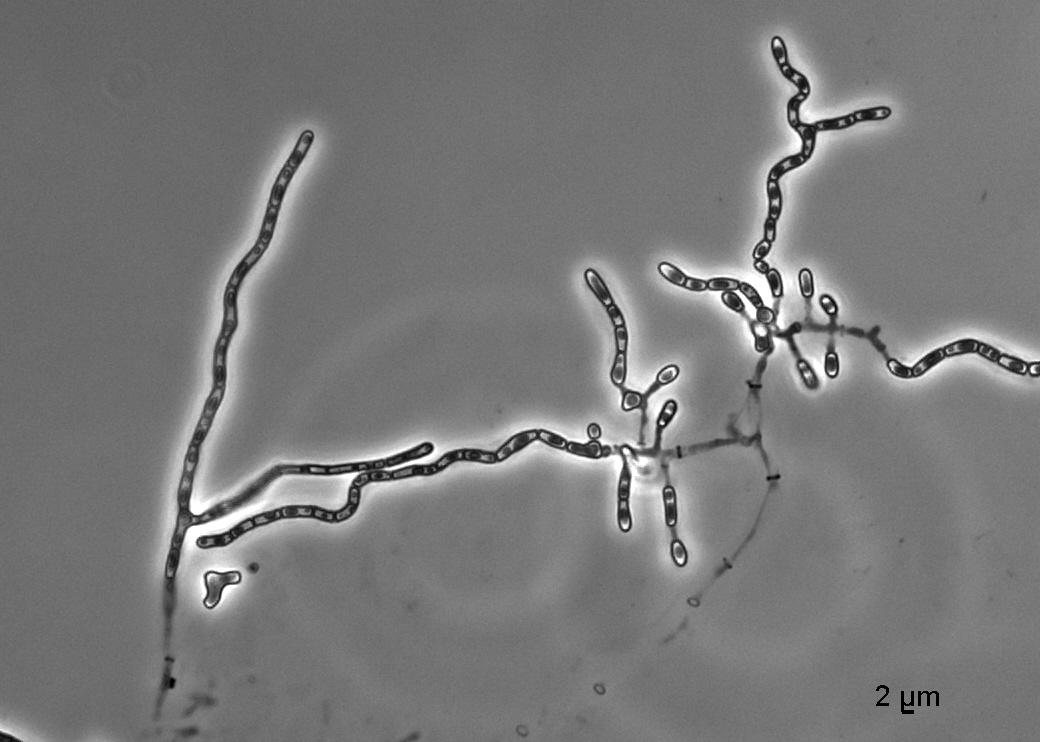 UAMH Centre for Global Microfungal Biodiversity